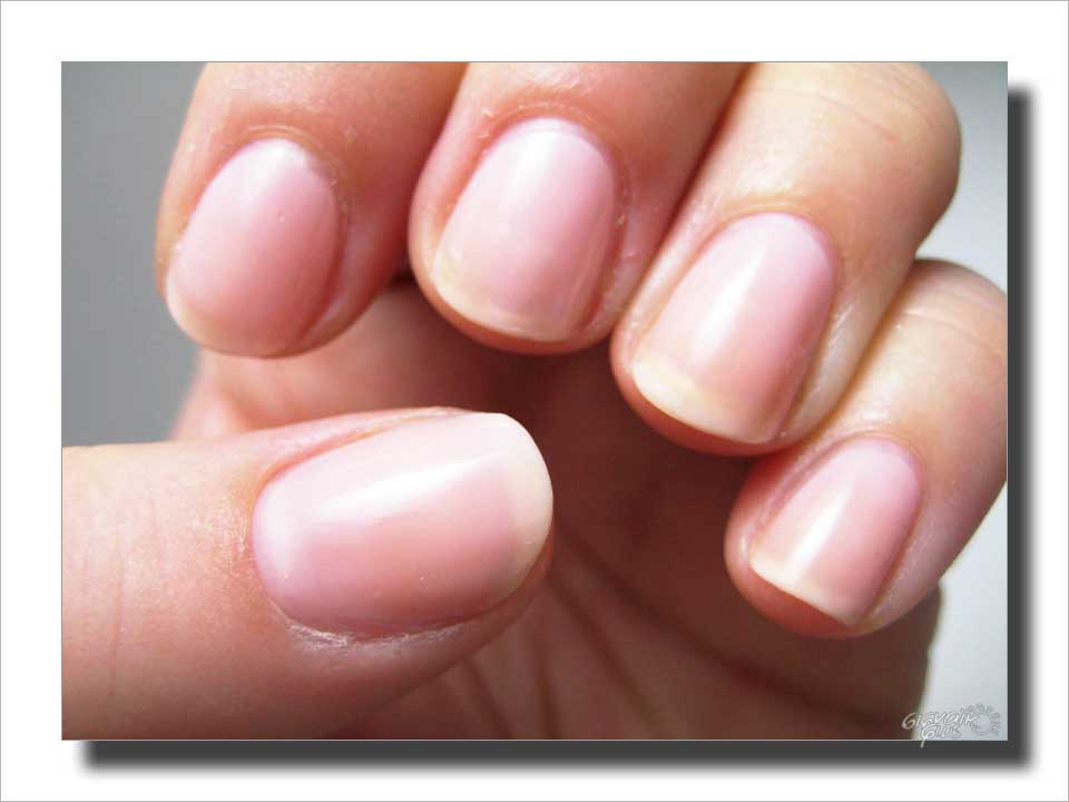 ygii_nyhia – sifnaiko-fos